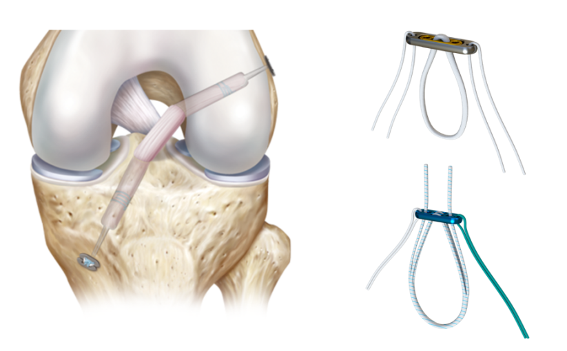 News - Upcoming Exhibitions：CMEF 14-17 May